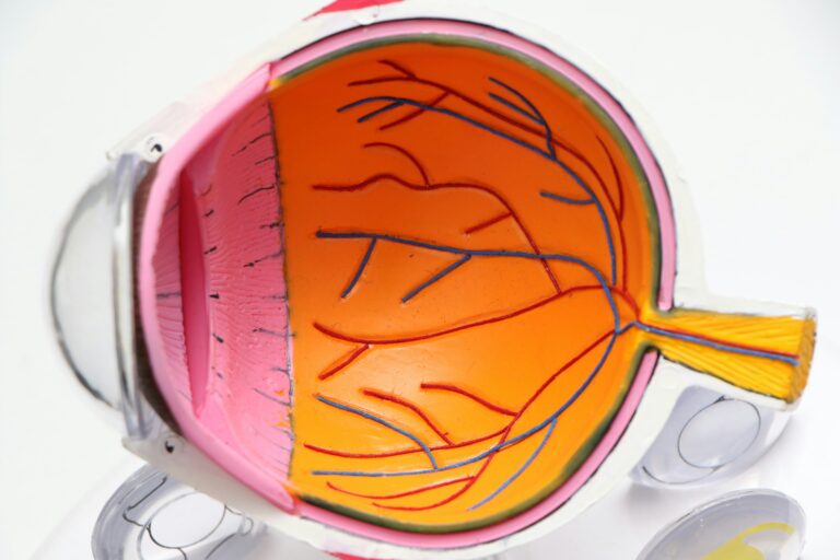 Strabismus (Crossed Eyes): Causes, Treatments, How to Improve Vision
